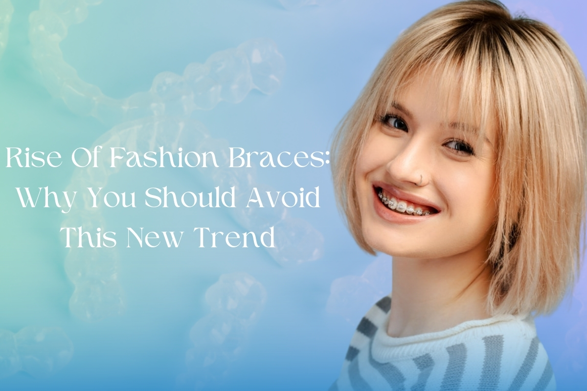 Fashion Braces: A Trend to Skip